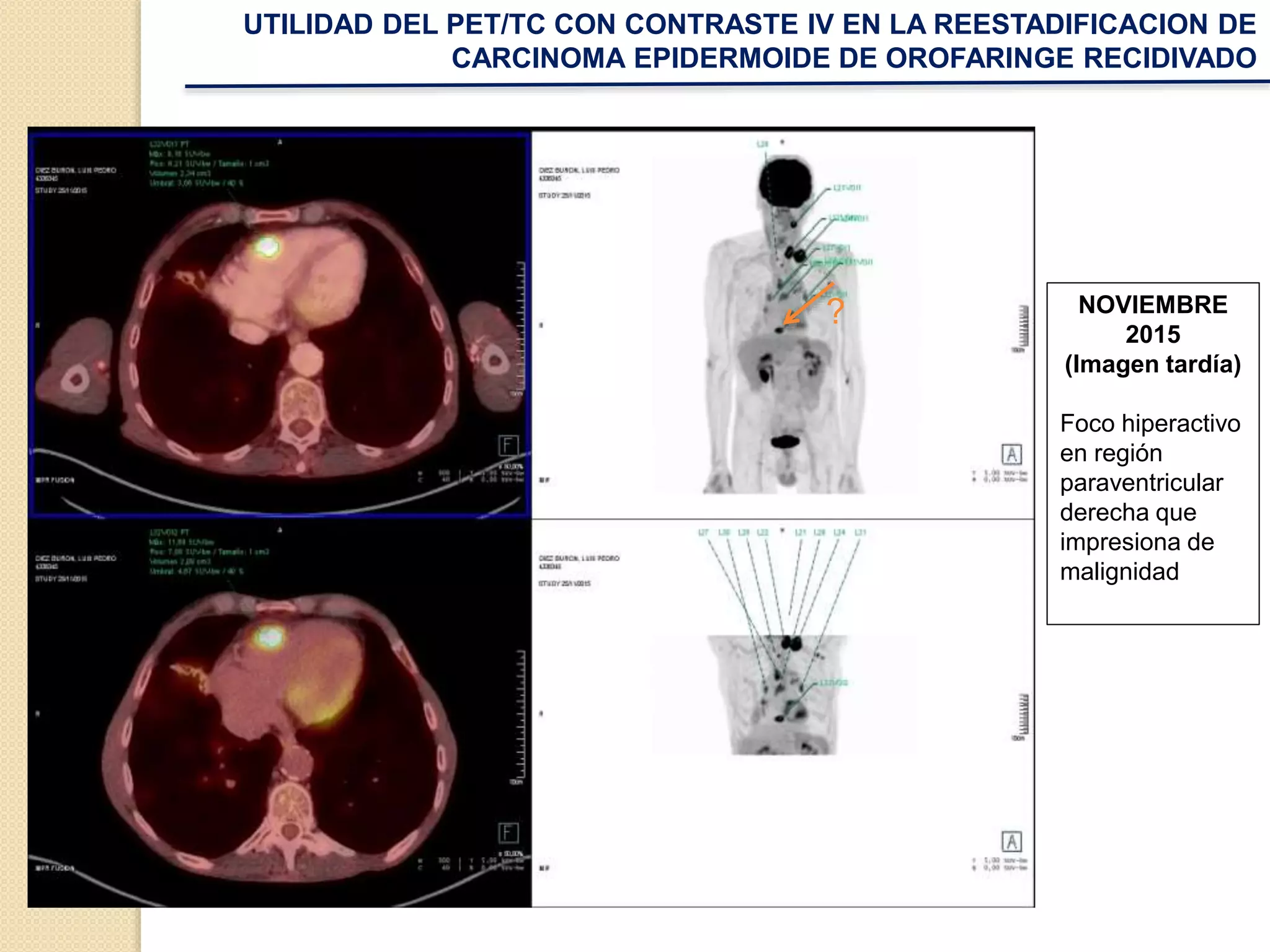 Utilidad PET/TAC contraste | PPTX