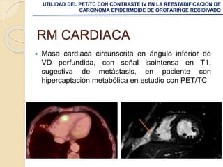 Utilidad PET/TAC contraste | PPTX