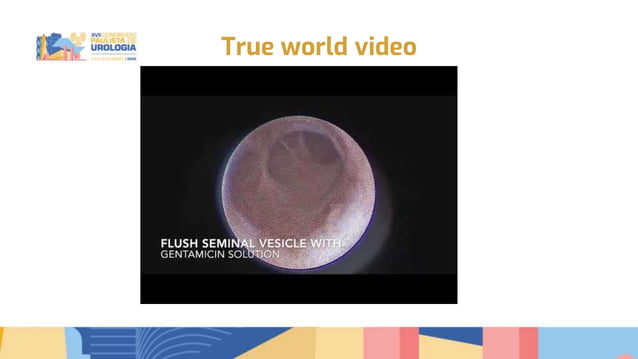 Transurethral seminal vesiculoscopy for chronic pelvic pain syndrome ...