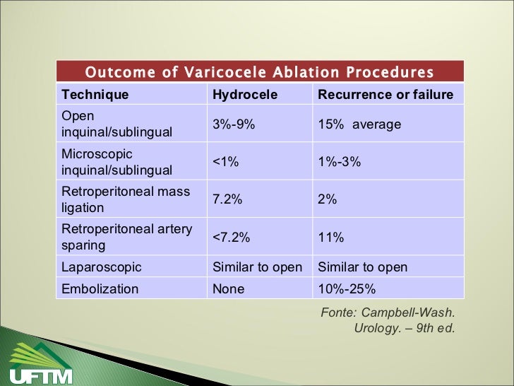 Varicocele - Diagnóstico