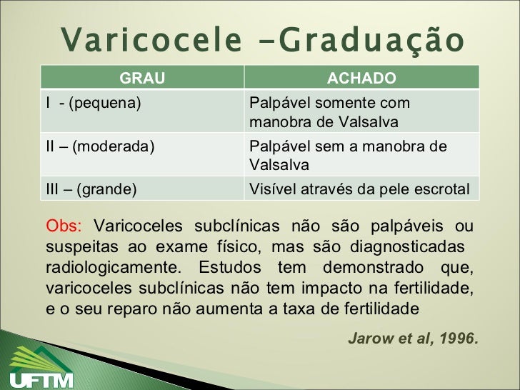 Varicocele - Diagnóstico