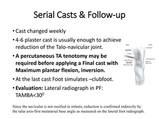 Congenital vertical talus Pes Plano Valgus | PPTX