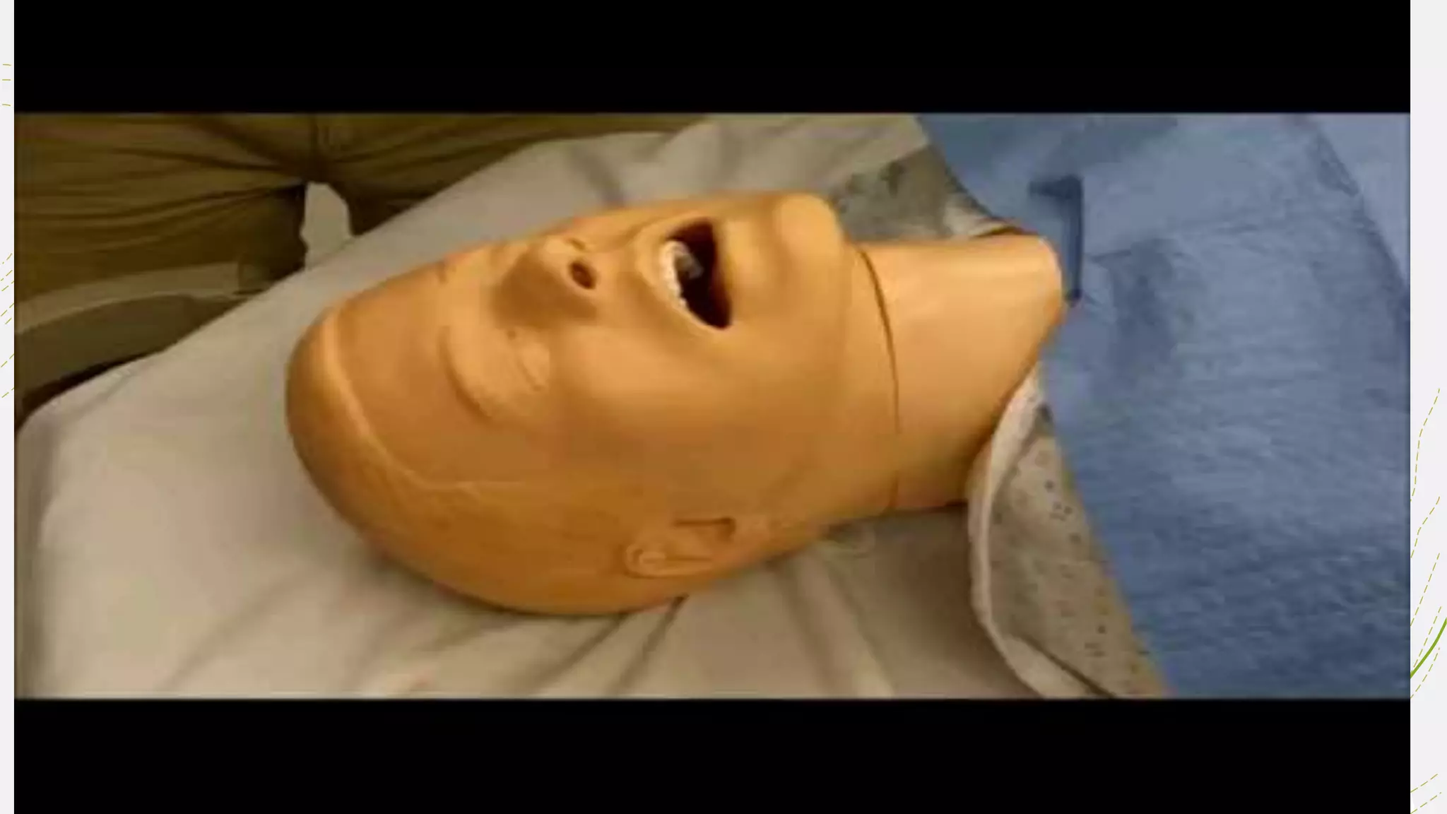 Coniotomy eman abdelrazek 1420.pptx