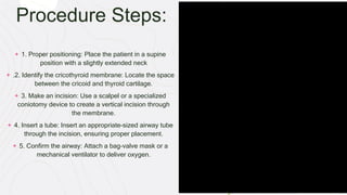 Coniotomy eman abdelrazek 1420.pptx