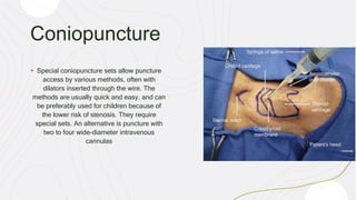 Coniotomy eman abdelrazek 1420.pptx