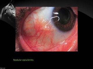 Conj lymphma clinic app. | PPT