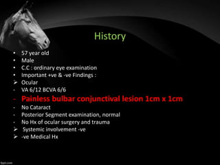 Conj lymphma clinic app. | PPT