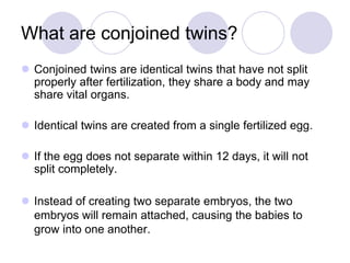 Conjoined Twins.ppt