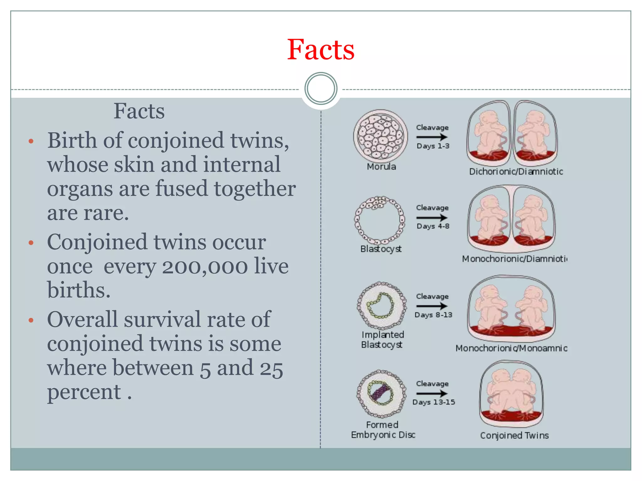 Conjoined Twins J | PPTX
