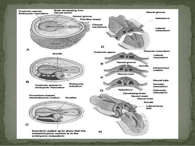 Conjoint twins - case n review
