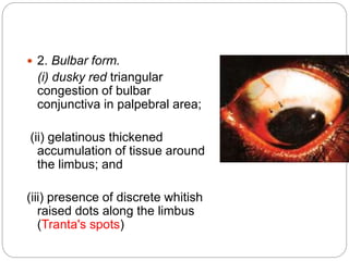 CONJUCTIVA-2.pptx