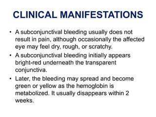 Conjuctival disorders | PPT