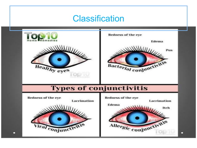 Conjuctival disorders | PPT