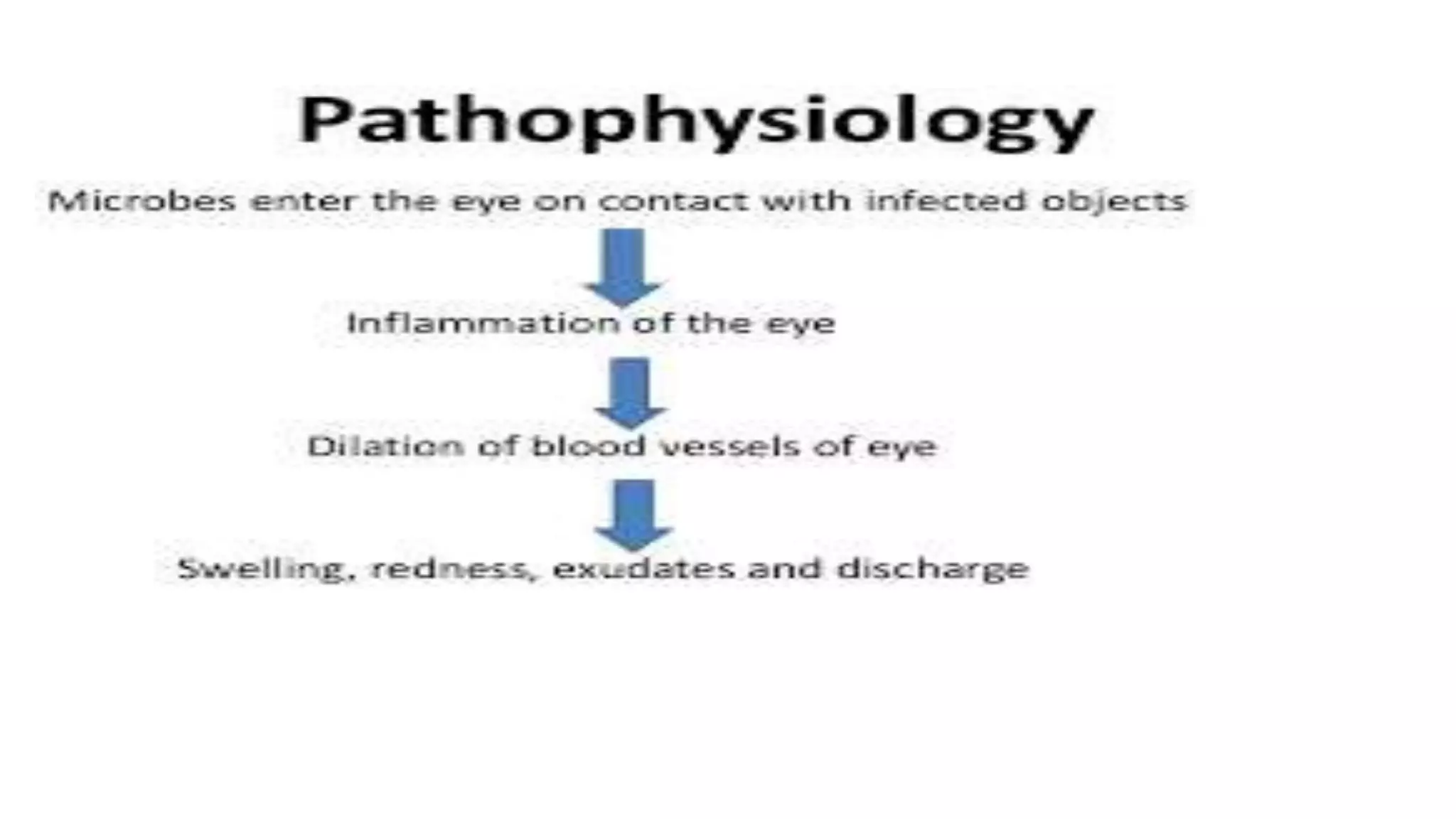 Conjunctivitis | PPTX