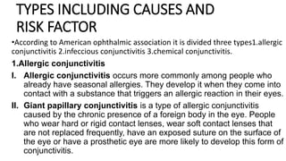 Conjunctivitis | PPTX