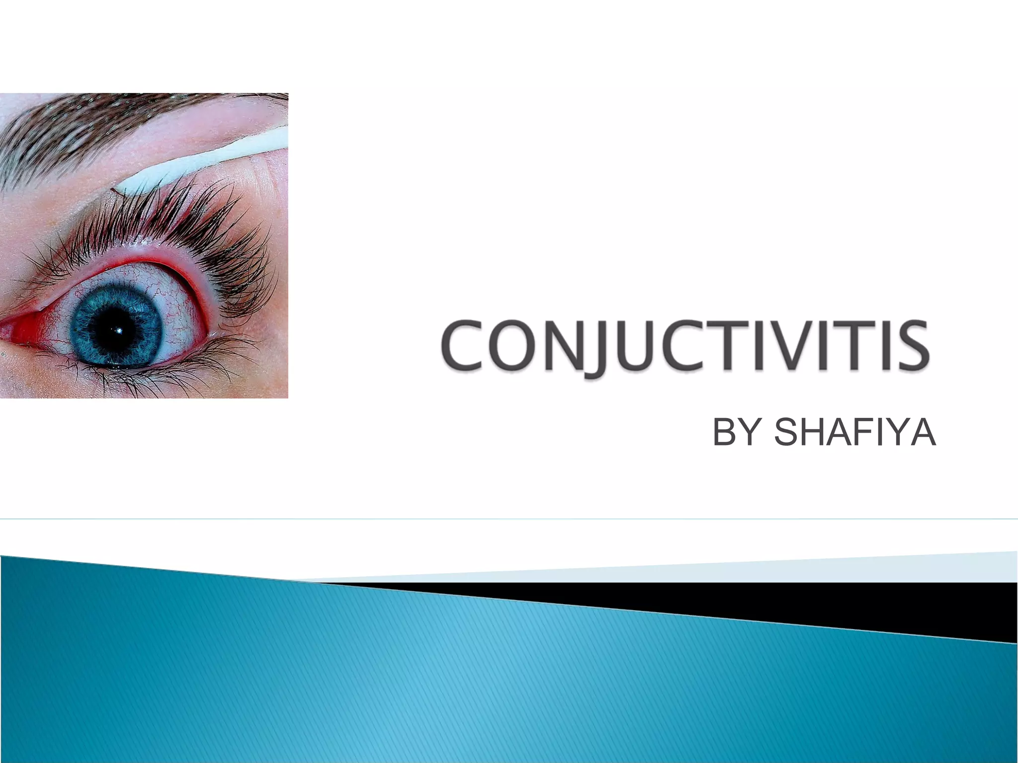 Conjuctivitis. | PPT