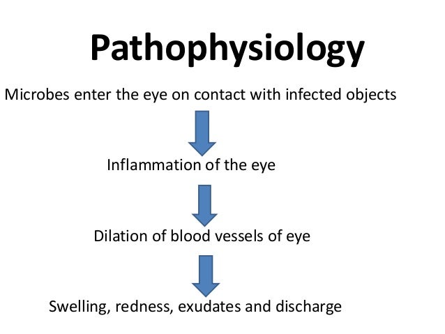 Conjuctivitis
