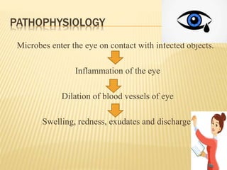 Conjuctivitis | PPTX