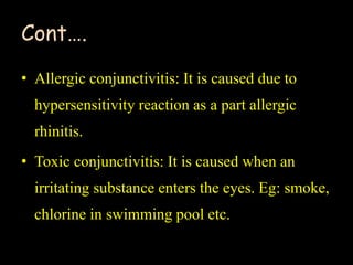 Conjunctivitis | PPTX