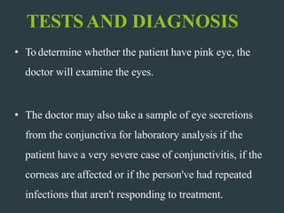 Conjuctivitis | PPTX