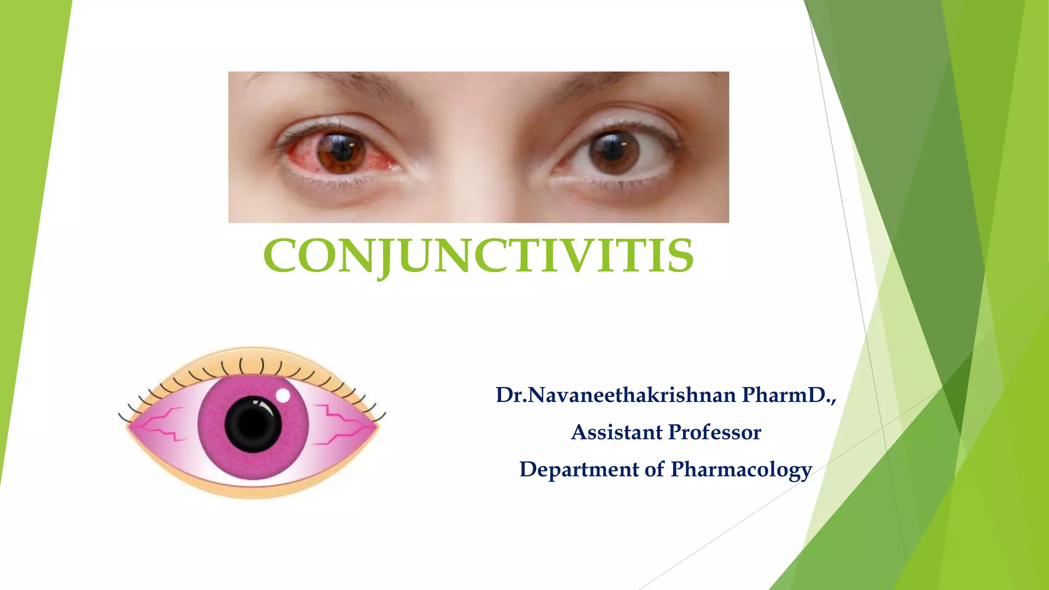 Conjuctivitis.pptx