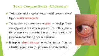 Conjuctivitis.pptx