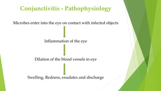 Conjuctivitis.pptx