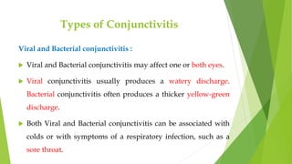 Conjuctivitis.pptx