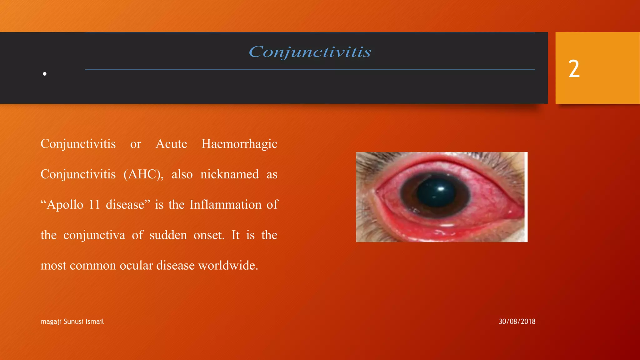 Conjuctivitis ppt | PPTX