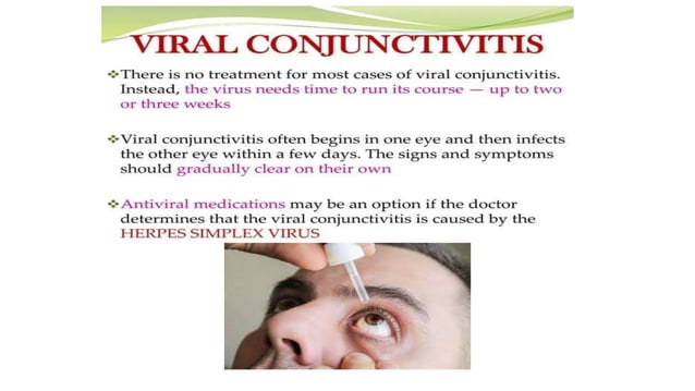CONJUCTIVITIS FINAL | PPTX | Eye and Vision Conditions | Diseases and ...