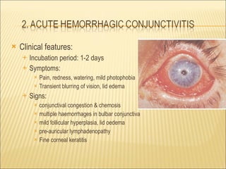 Acute Hemorrhagic Conjunctivitis