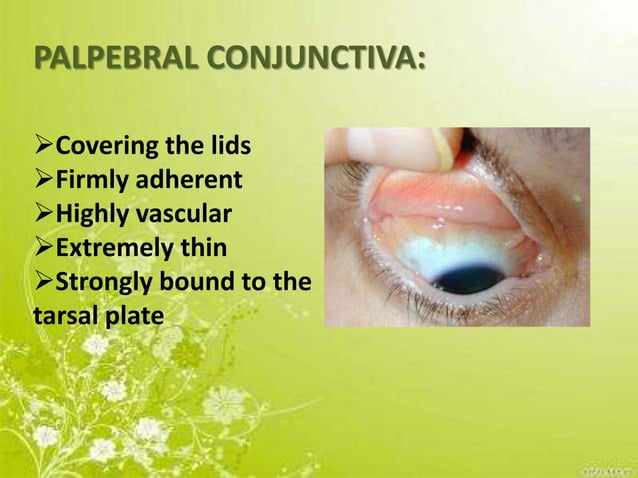 Conjunctiva | PPTX
