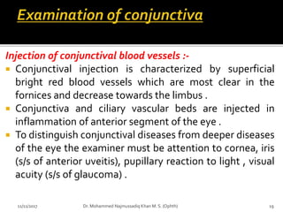 Conjunctiva Inspection