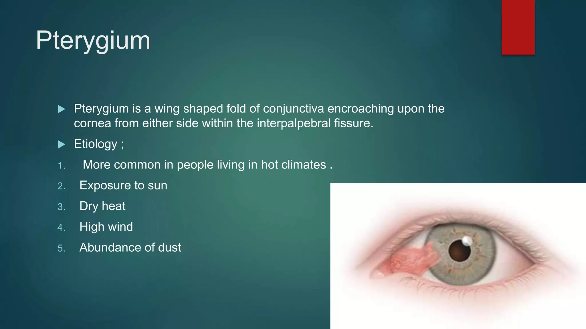 Conjunctiva and its Disorders | PPTX