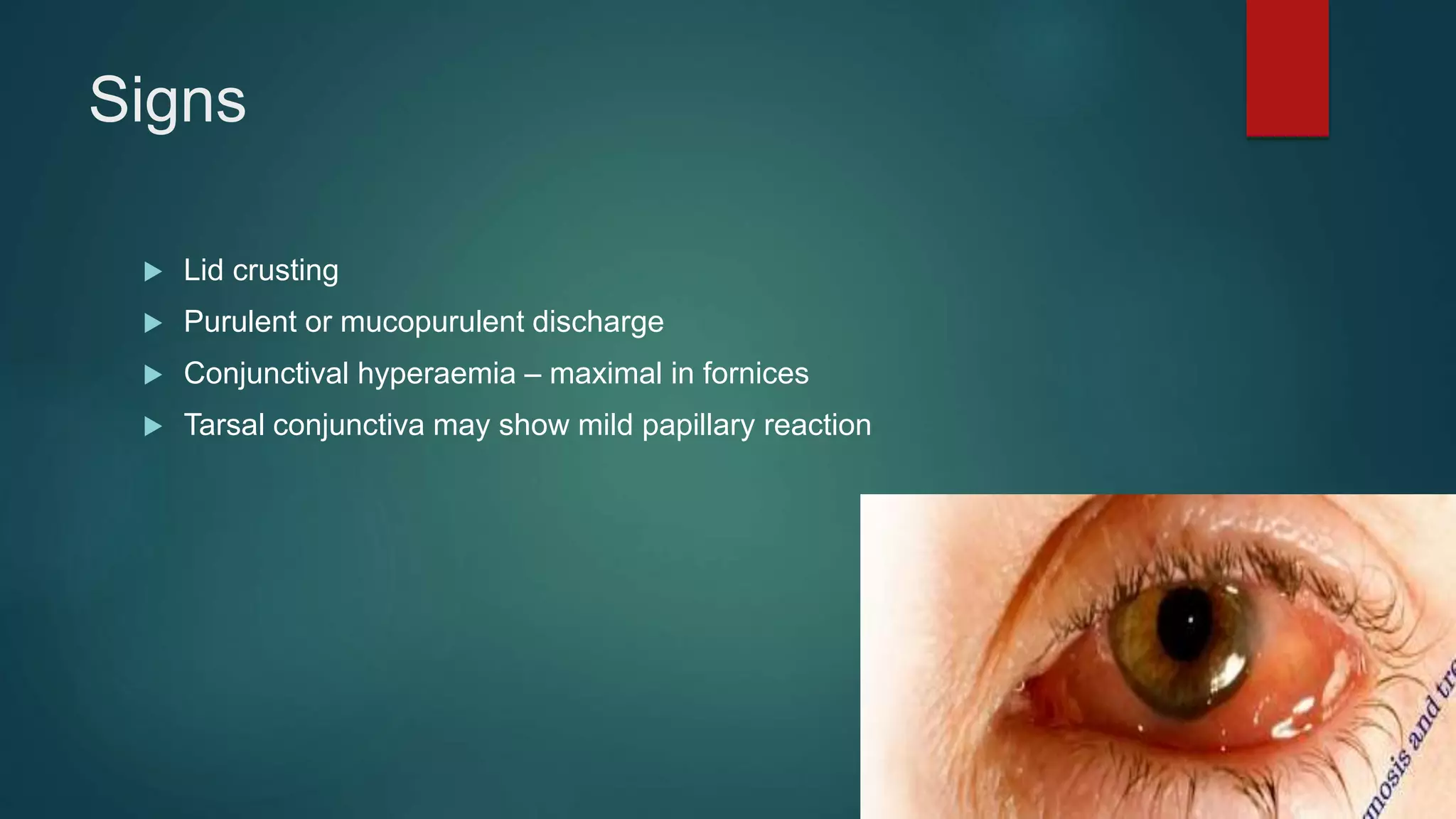Conjunctiva and its Disorders | PPTX