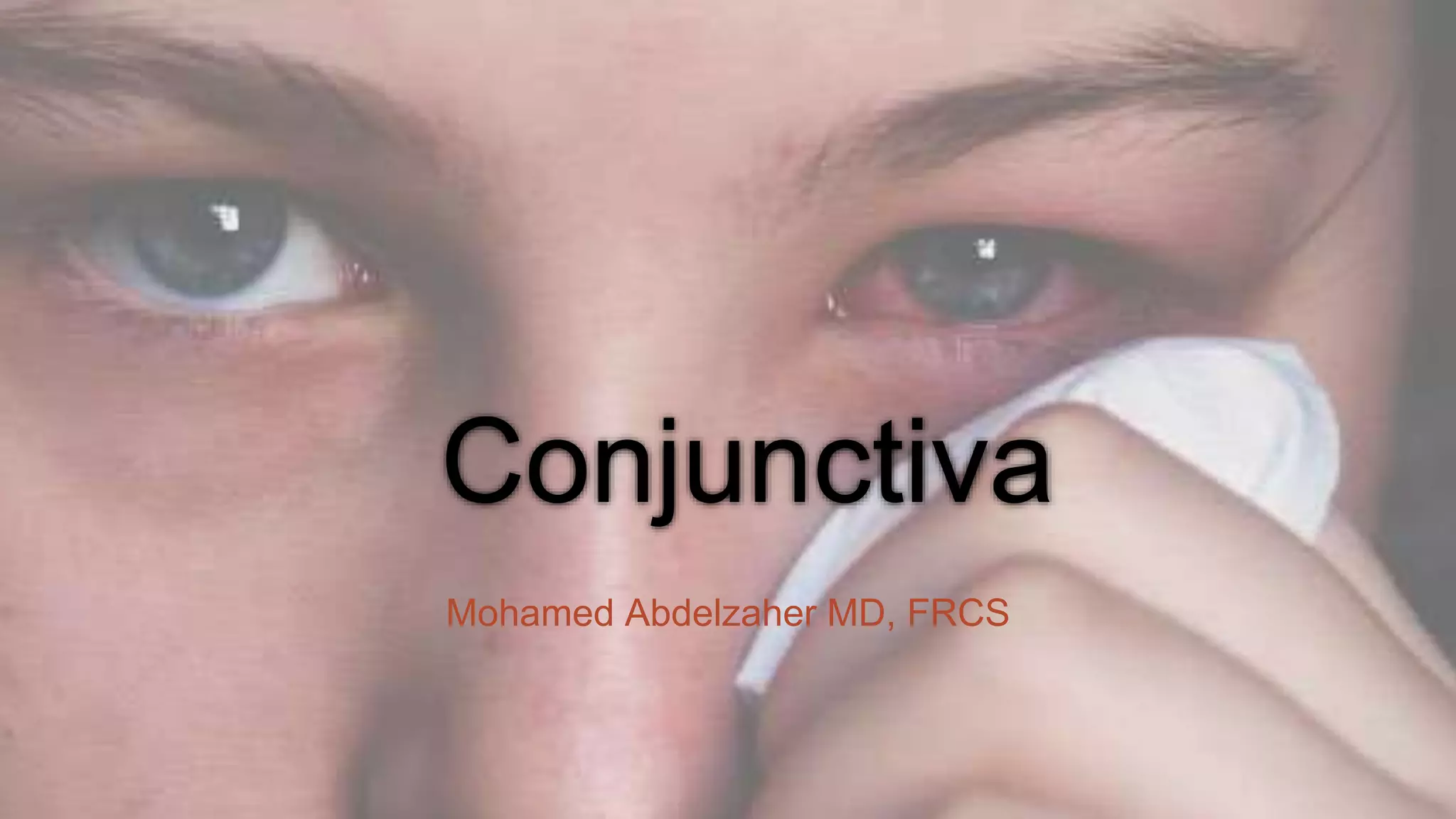 Conjunctiva | PPTX
