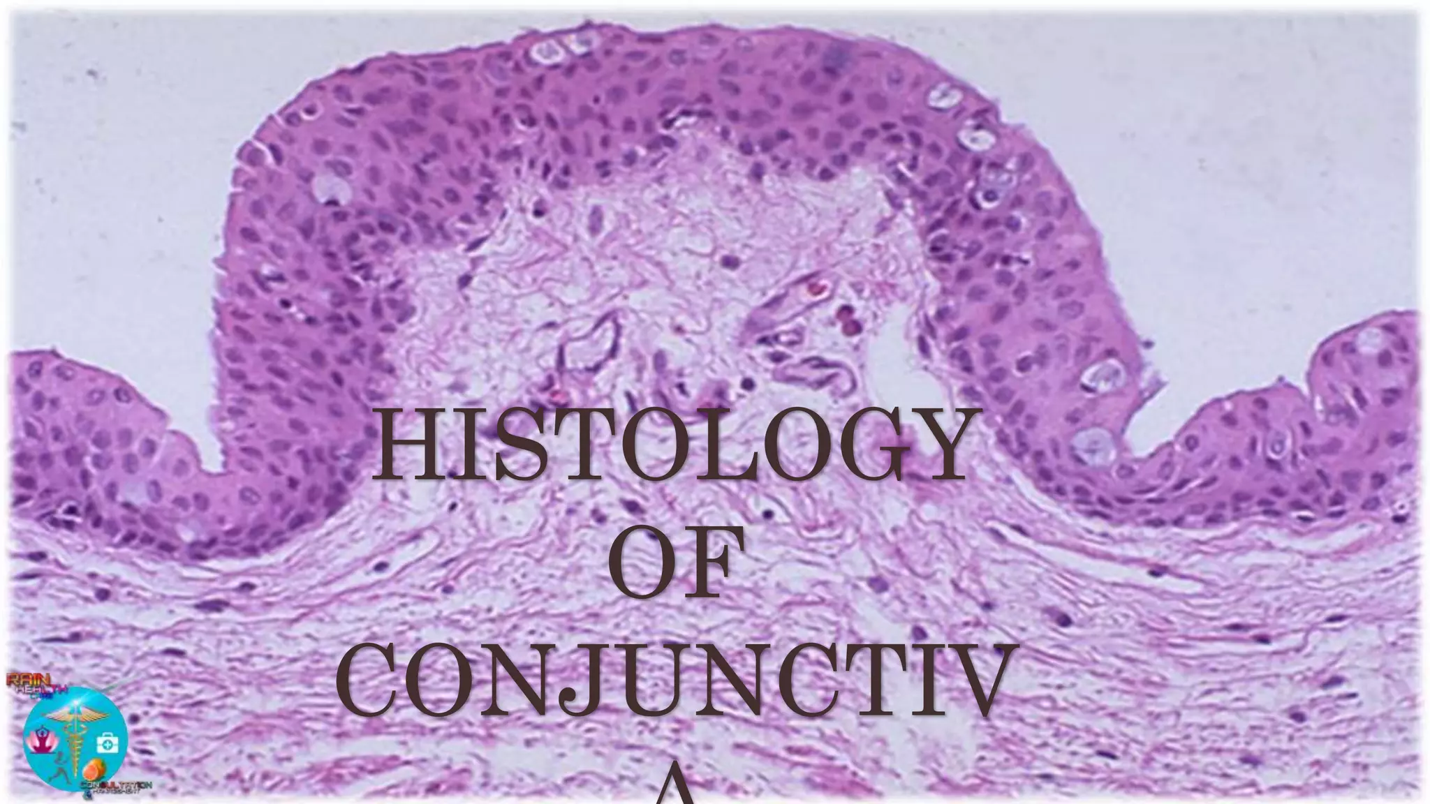 Anatomy And Histology Of Conjunctiva Pptx