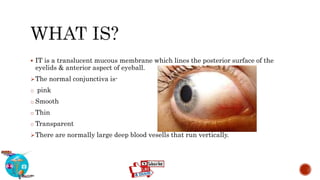 ANATOMY & HISTOLOGY OF CONJUNCTIVA | PPTX