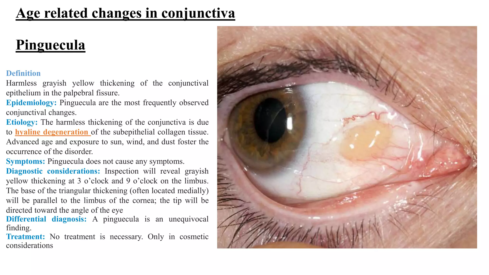 conjunctiva.pptx