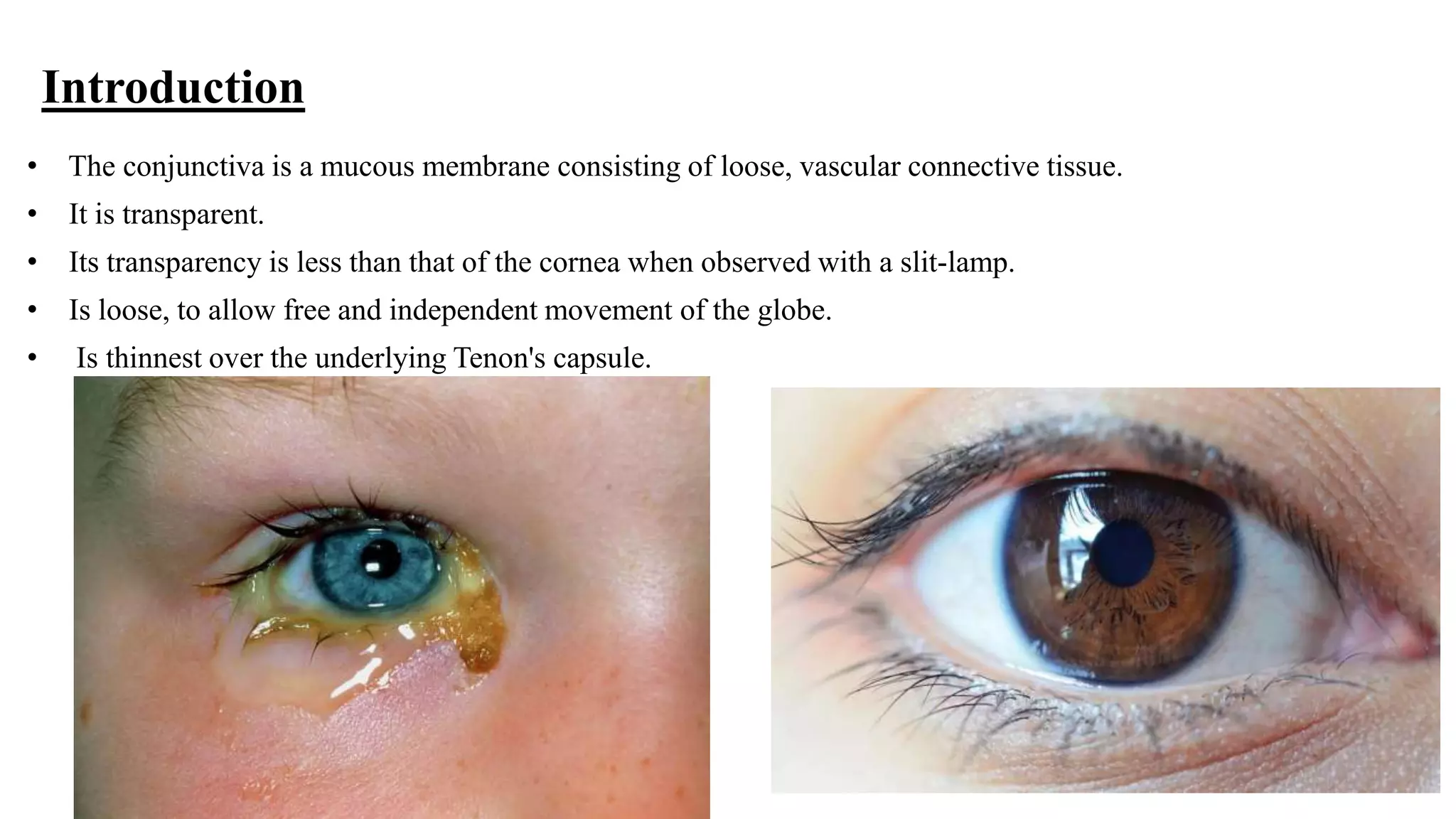 conjunctiva.pptx | Eye and Vision Conditions | Diseases and Conditions