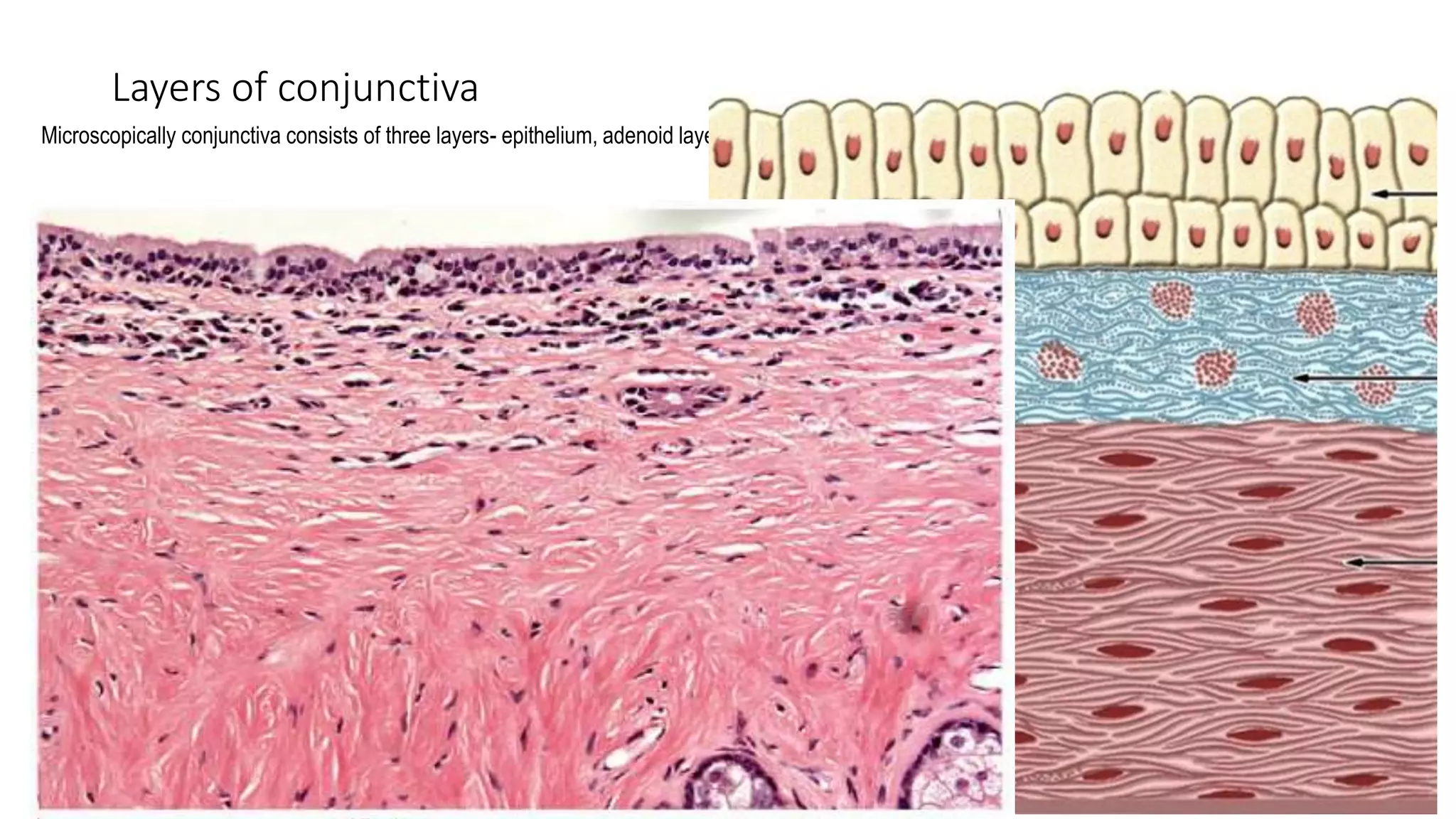 conjunctiva.pptx | Eye and Vision Conditions | Diseases and Conditions