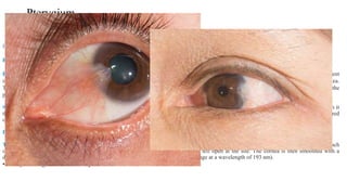 conjunctiva.pptx | Eye and Vision Conditions | Diseases and Conditions