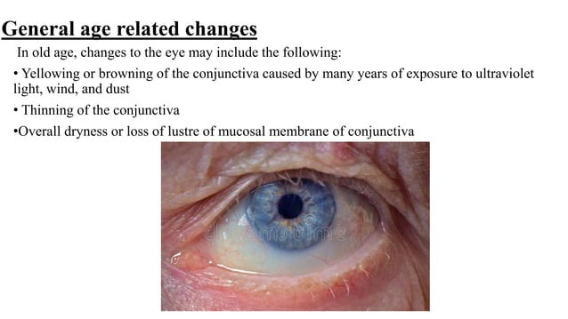 conjunctiva.pptx | Eye and Vision Conditions | Diseases and Conditions