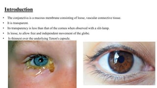 conjunctiva.pptx | Eye and Vision Conditions | Diseases and Conditions
