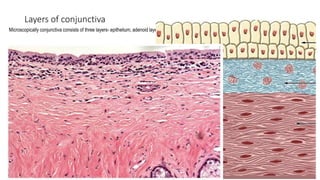 conjunctiva.pptx | Eye and Vision Conditions | Diseases and Conditions