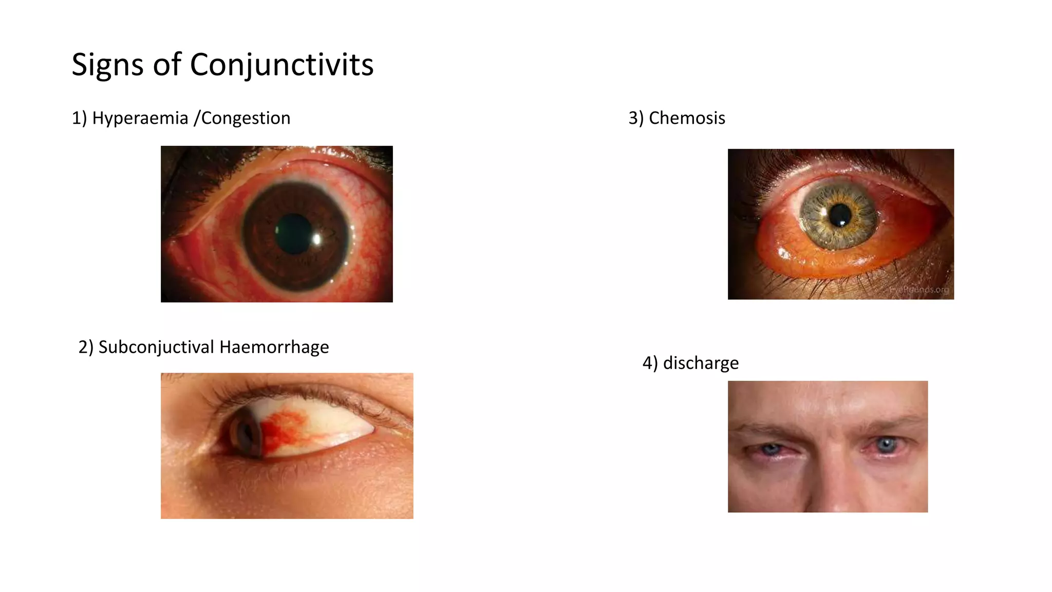 CONJUNCTIVA.pptx