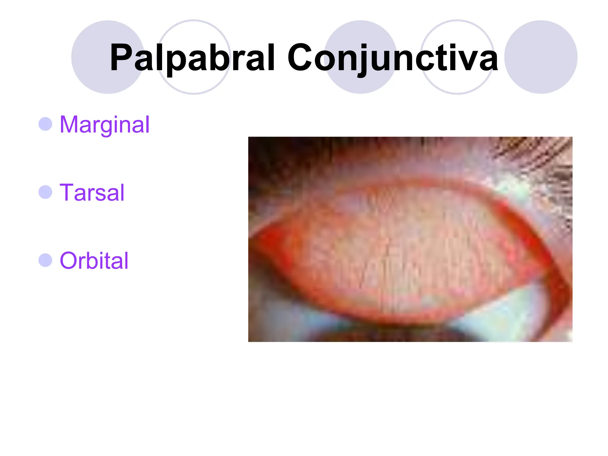 Anatomy of Conjunctiva- bulbar ,palpebral and forniceal | PPT