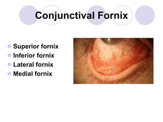 Anatomy of Conjunctiva- bulbar ,palpebral and forniceal | PPT