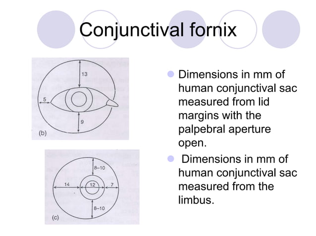 Anatomy of Conjunctiva- bulbar ,palpebral and forniceal | PPT | Eye and ...