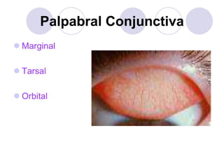 Anatomy of Conjunctiva- bulbar ,palpebral and forniceal | PPT